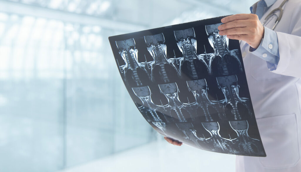 A surgeon checks a cervical spine x-ray and CT scan at an urgent care ...